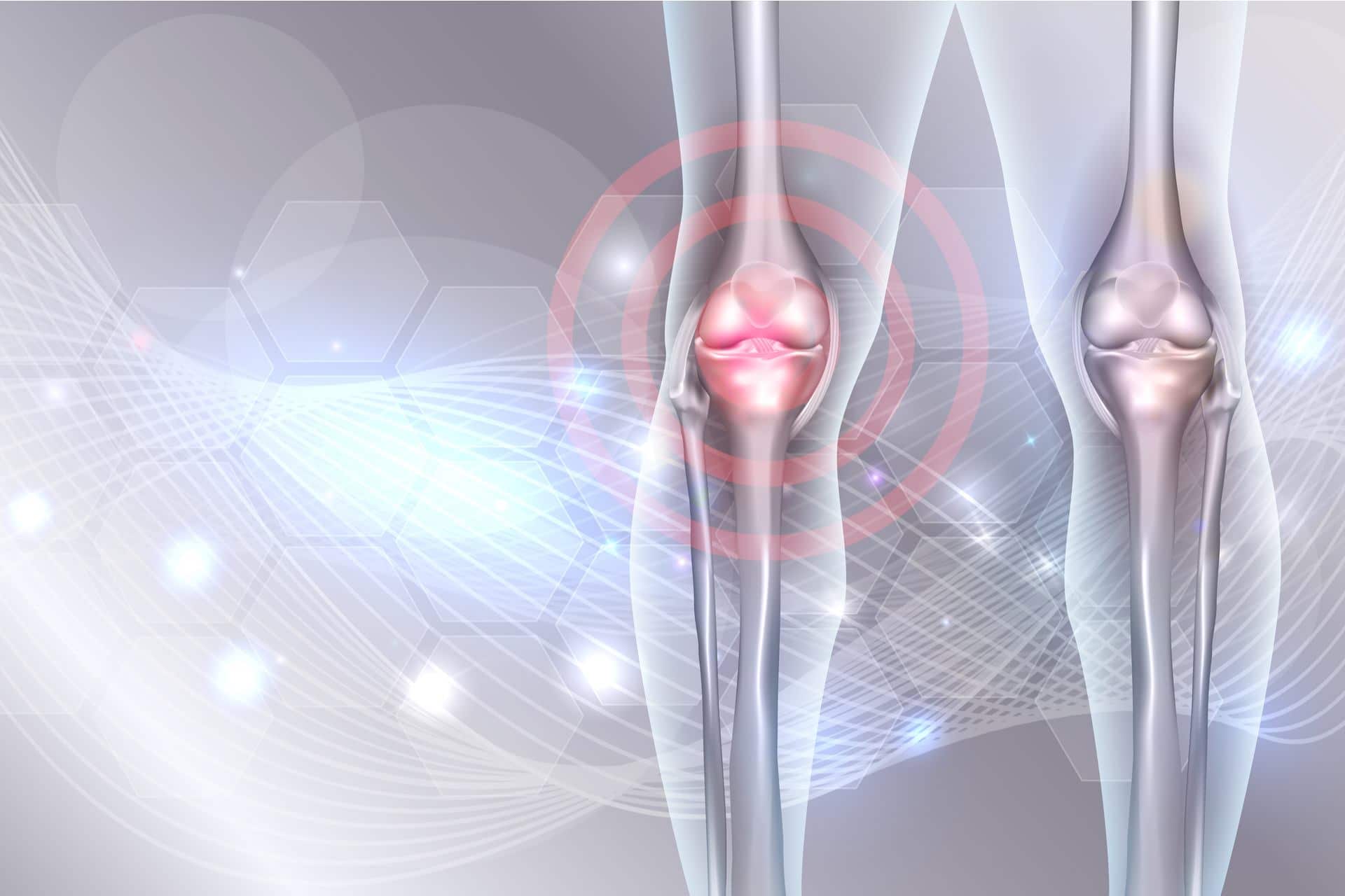 10 SIGNS IT MAY BE TIME TO REPLACE AN ACHING JOINT - Lowcountry ...
